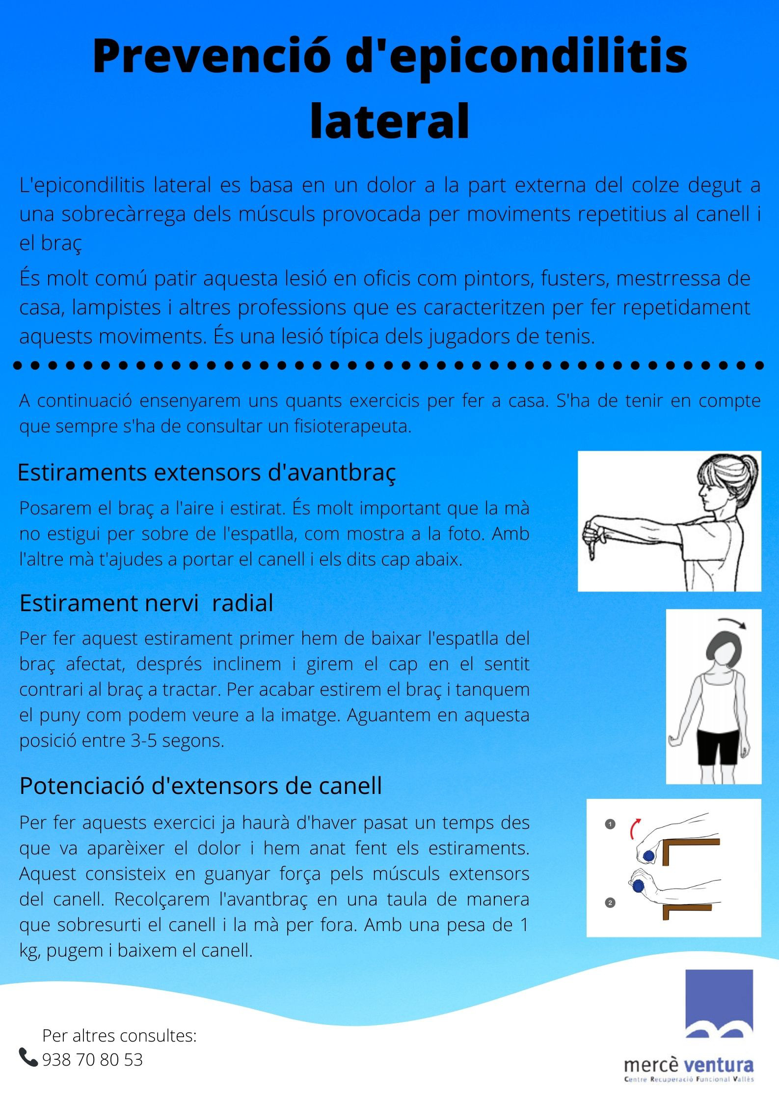 Prevenció d'epicondilitis lateral - Centre Recuperació Funcional Vallès.